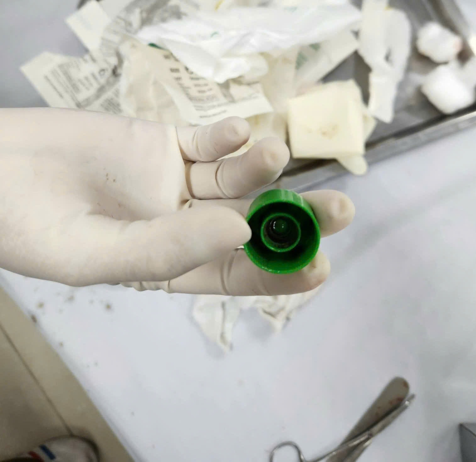 Dị vật nhỏ, hiểm họa lớn