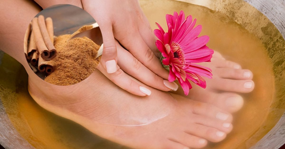 Bỏ túi cách trị mùi hôi ở chân hiệu quả bằng bột quế